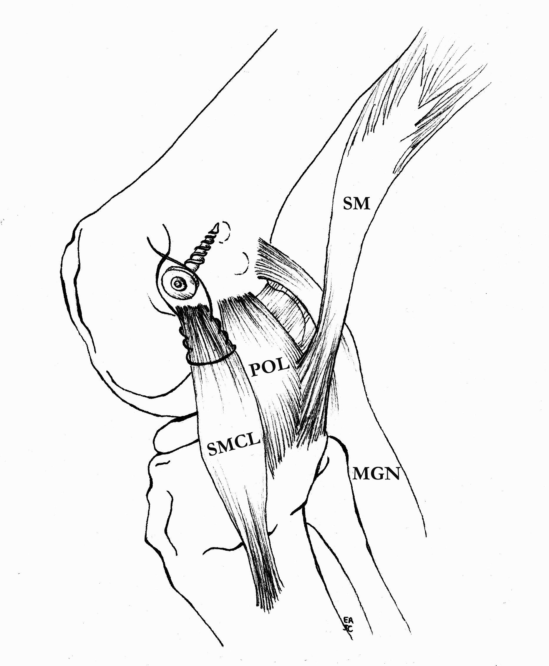 Technique ACL PCL and MCL | The Bone School