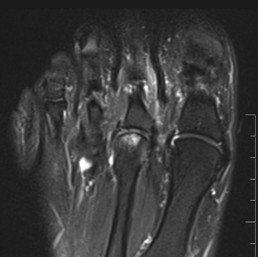 Freiberg's | The Bone School