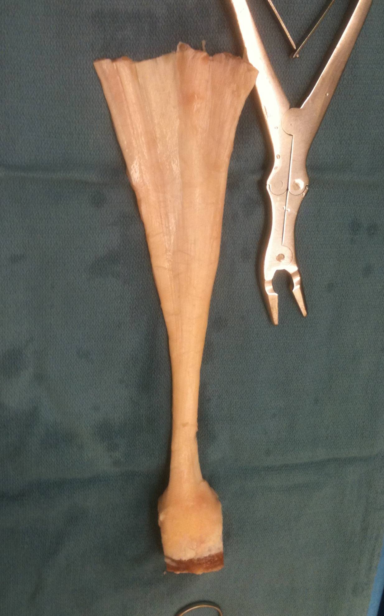 Technique ACL PCL Posterolateral Corner | The Bone School