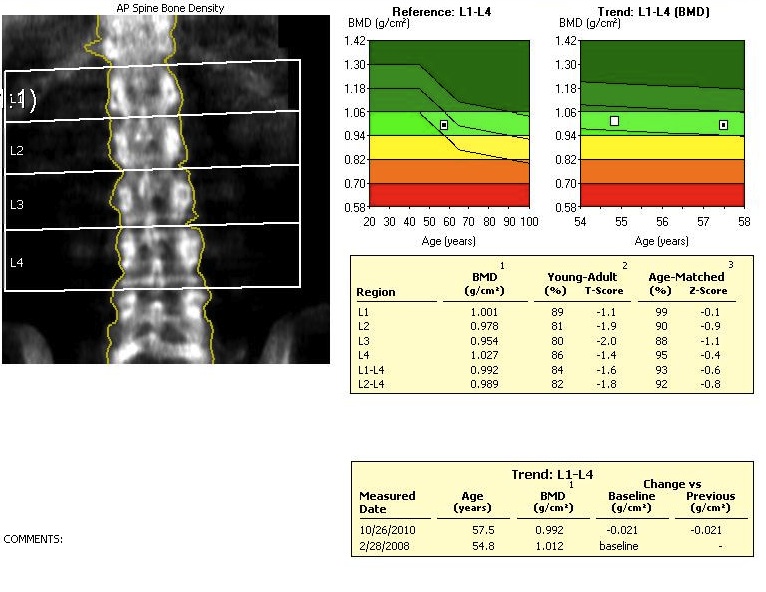 Osteoporosis | The Bone School
