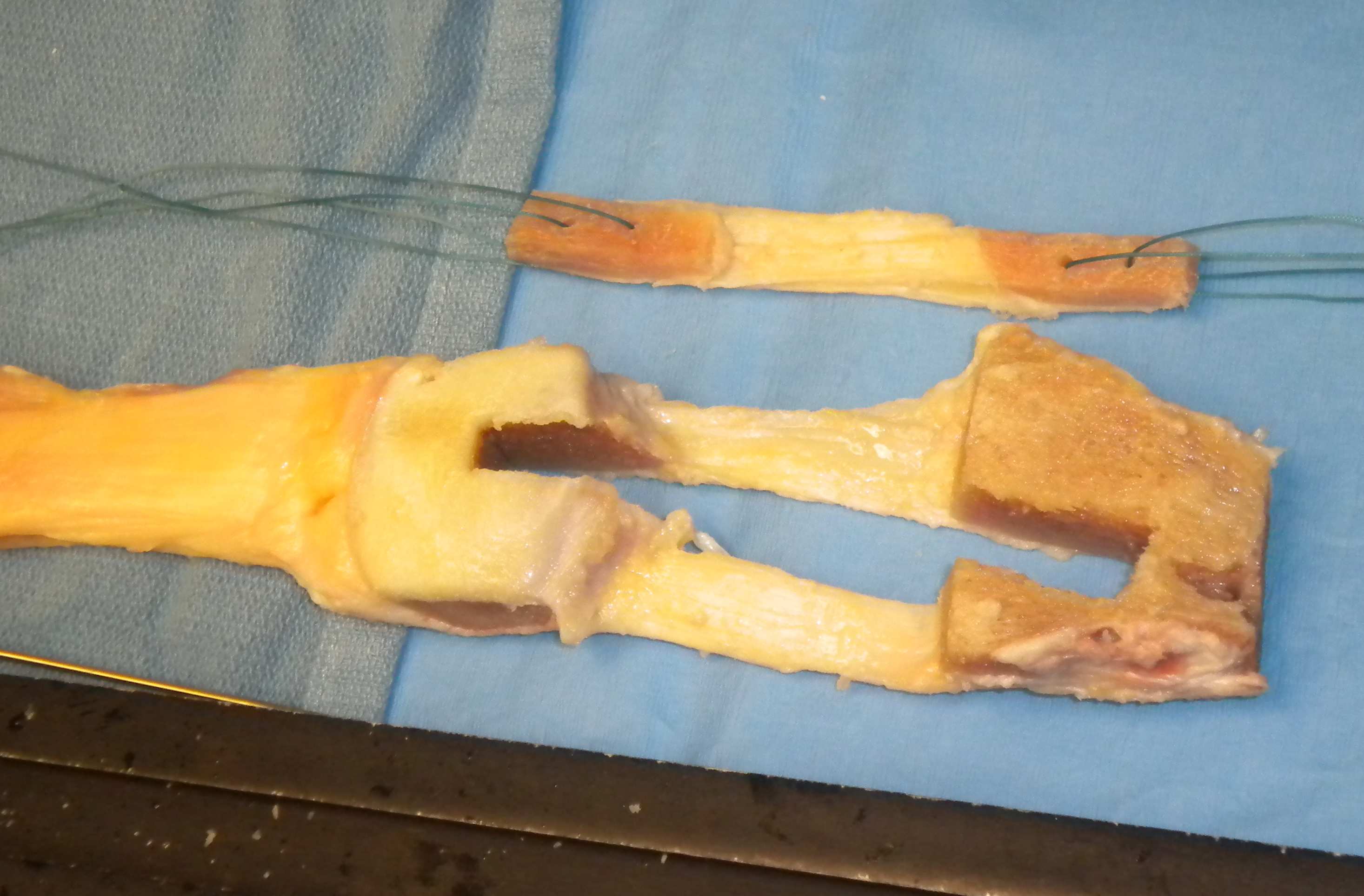 BPTB Allograft | The Bone School