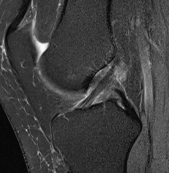 Assessment | The Bone School