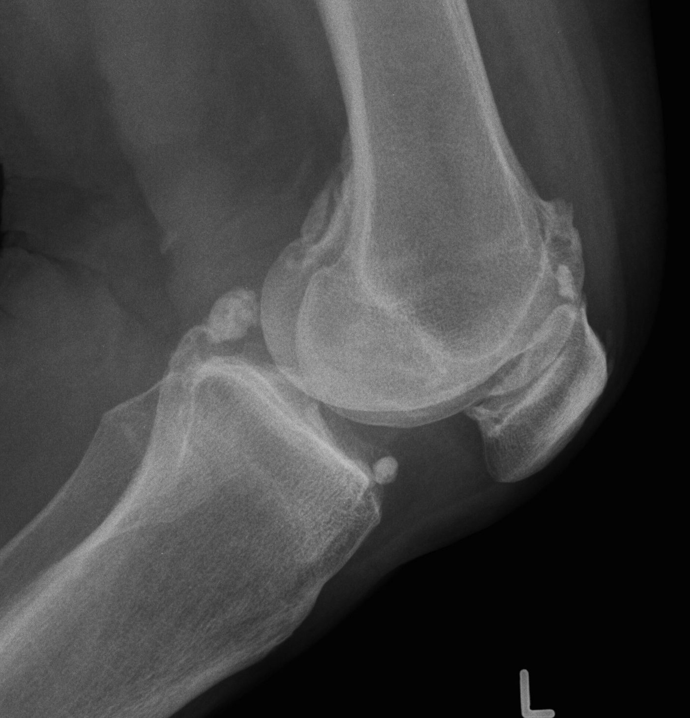 Loose Bodies | The Bone School