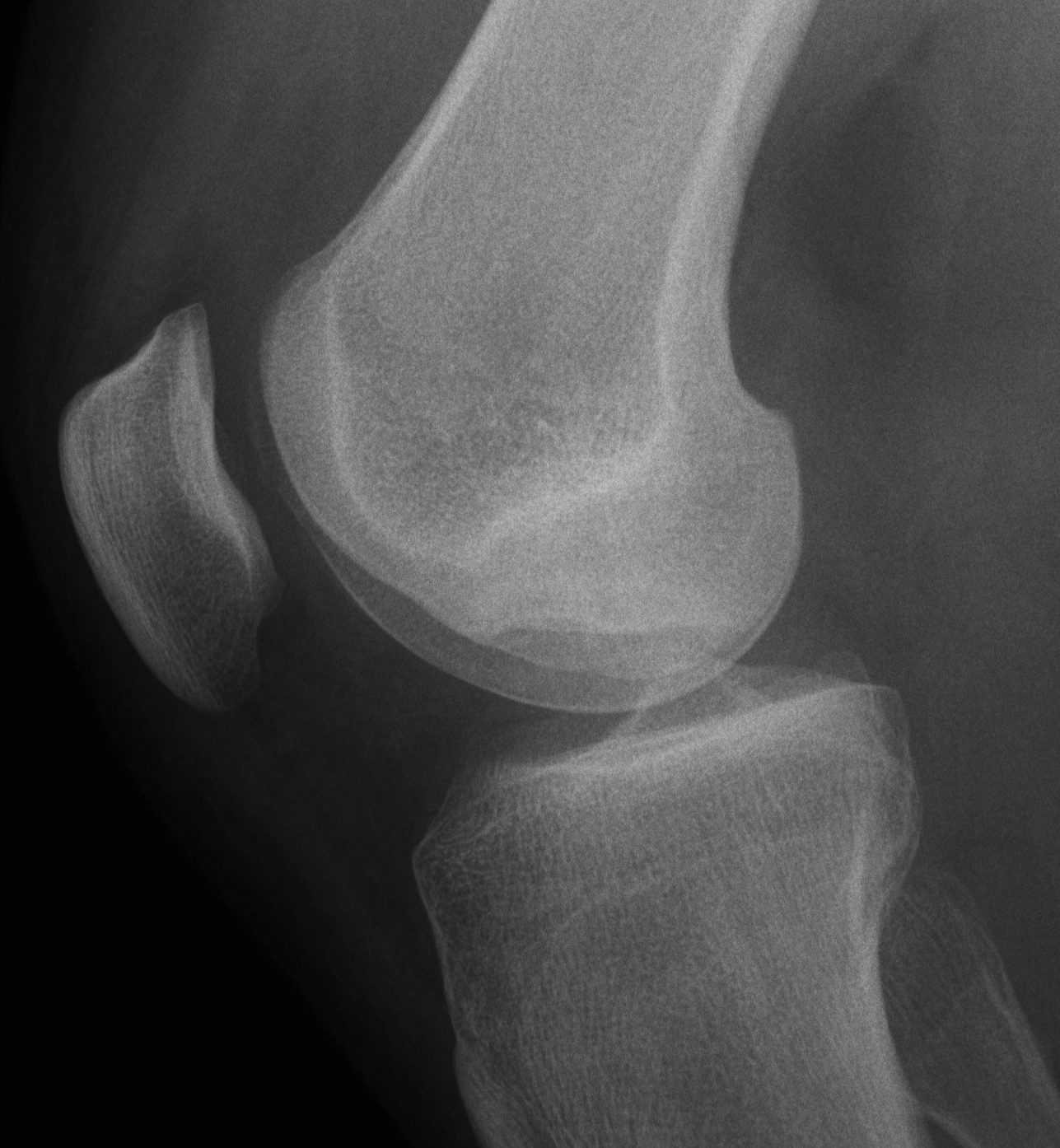 Background | The Bone School