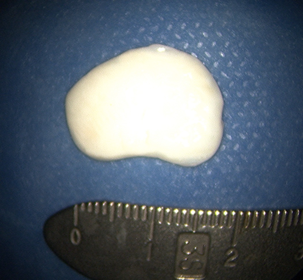 Loose Bodies | The Bone School