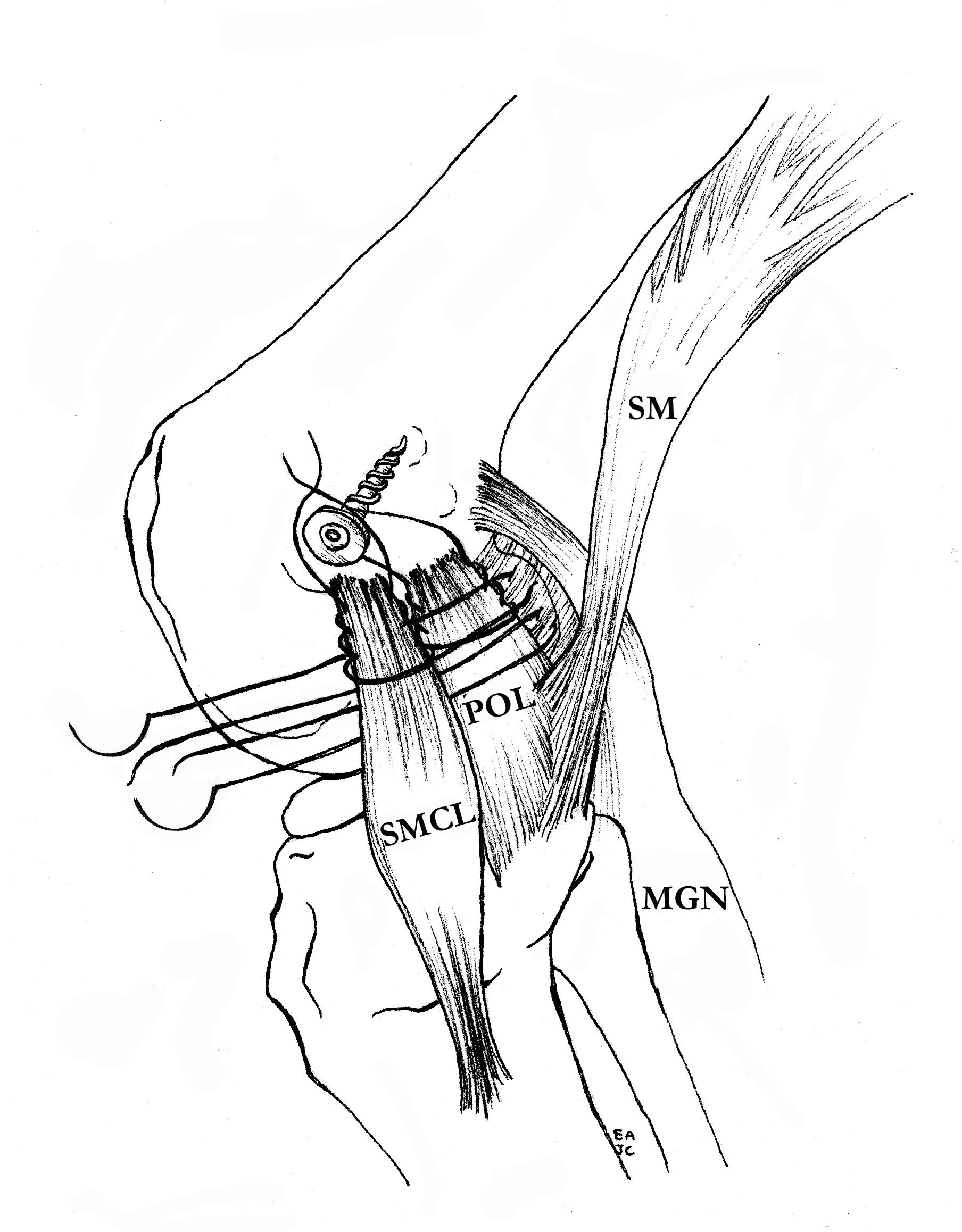 MCL and Posteromedial Corner | The Bone School