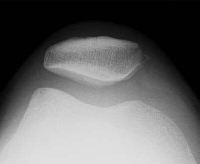 Investigation | The Bone School