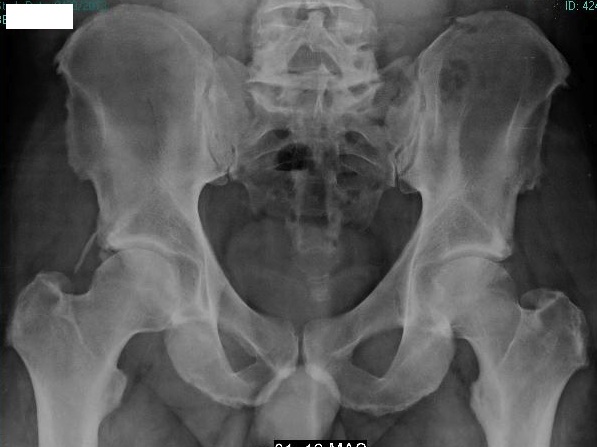 DISH | The Bone School