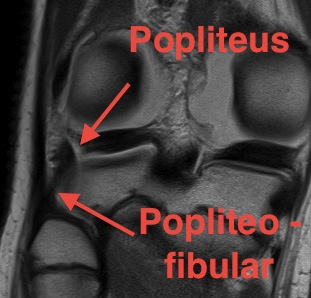 Acute PLC Background | The Bone School