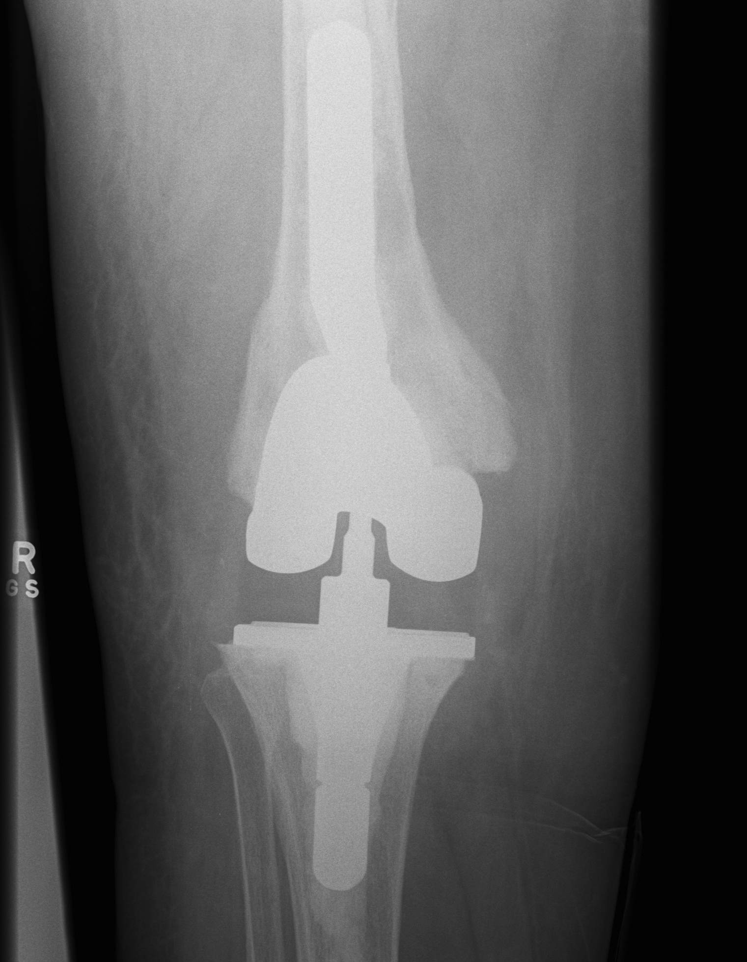 Constraint | The Bone School