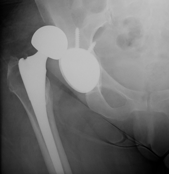 Dislocation | The Bone School