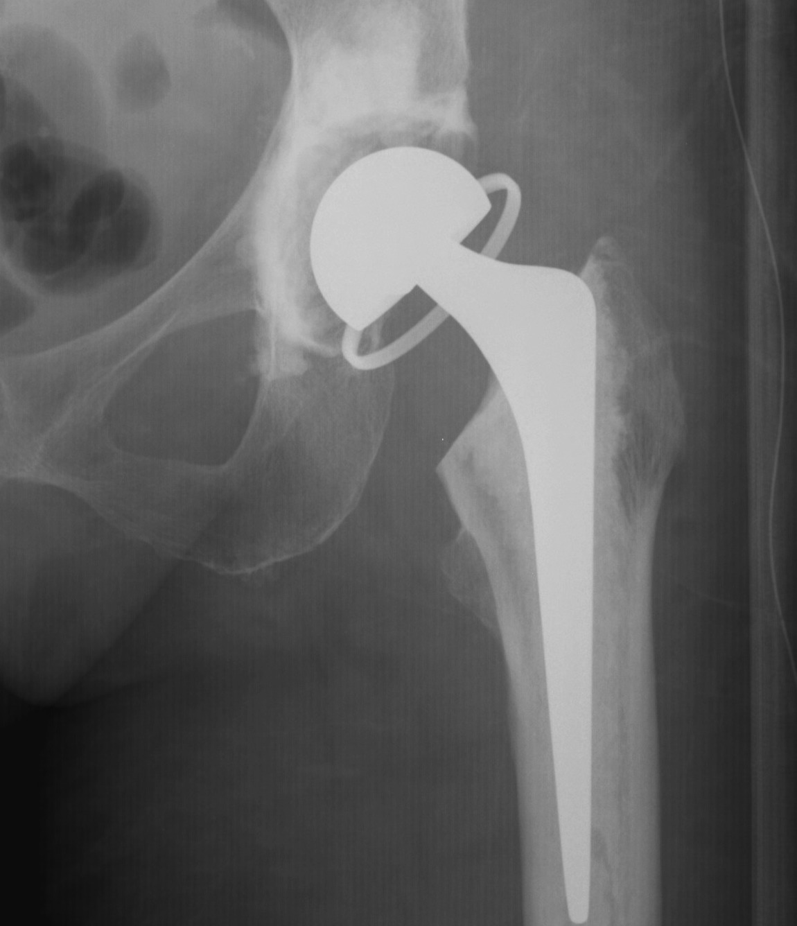 Dislocation | The Bone School