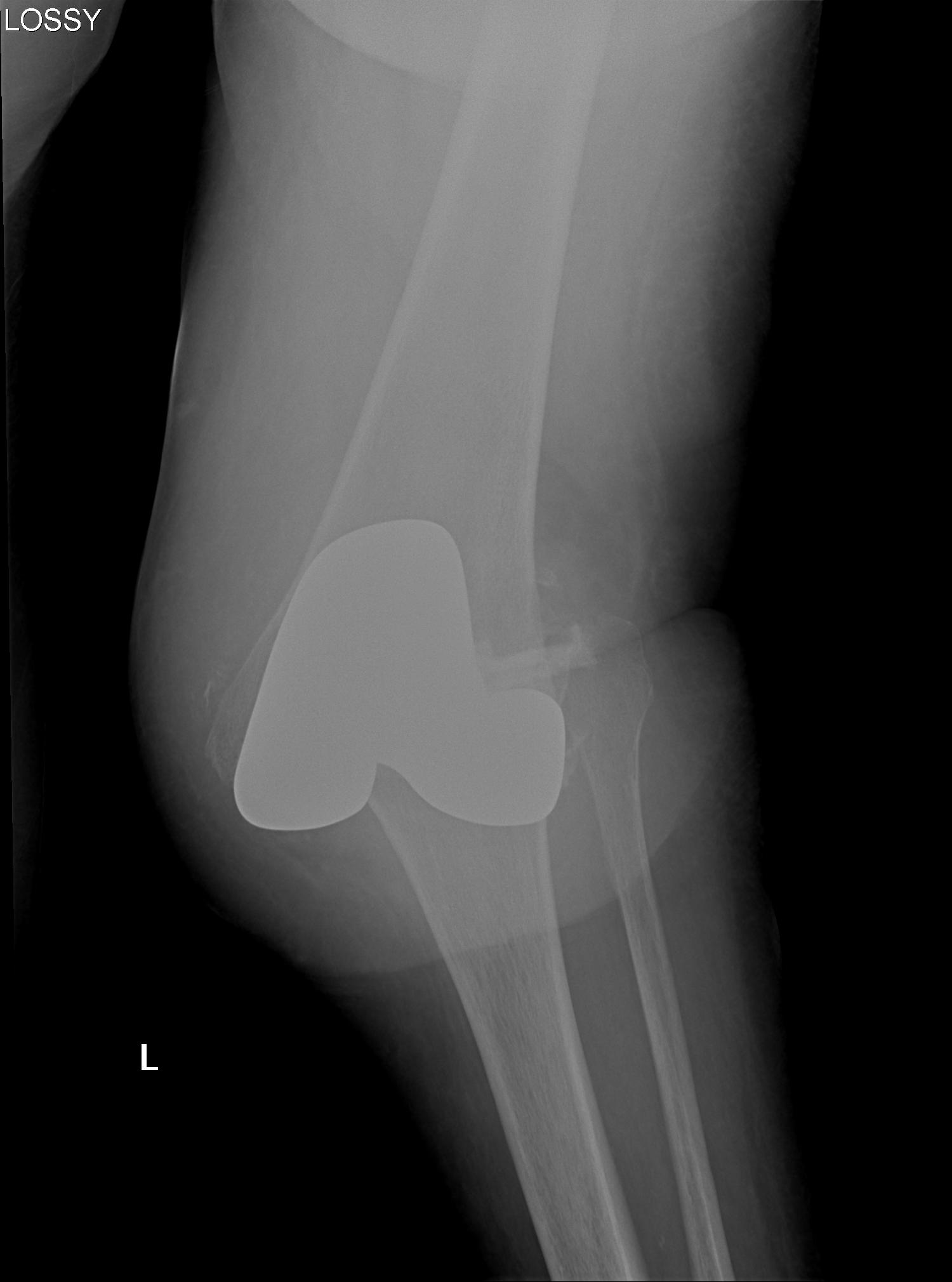 dislocation | The Bone School