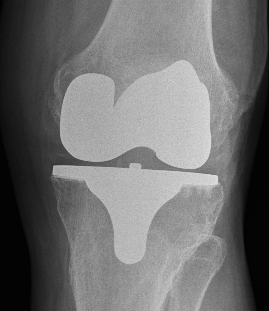 Instability | The Bone School