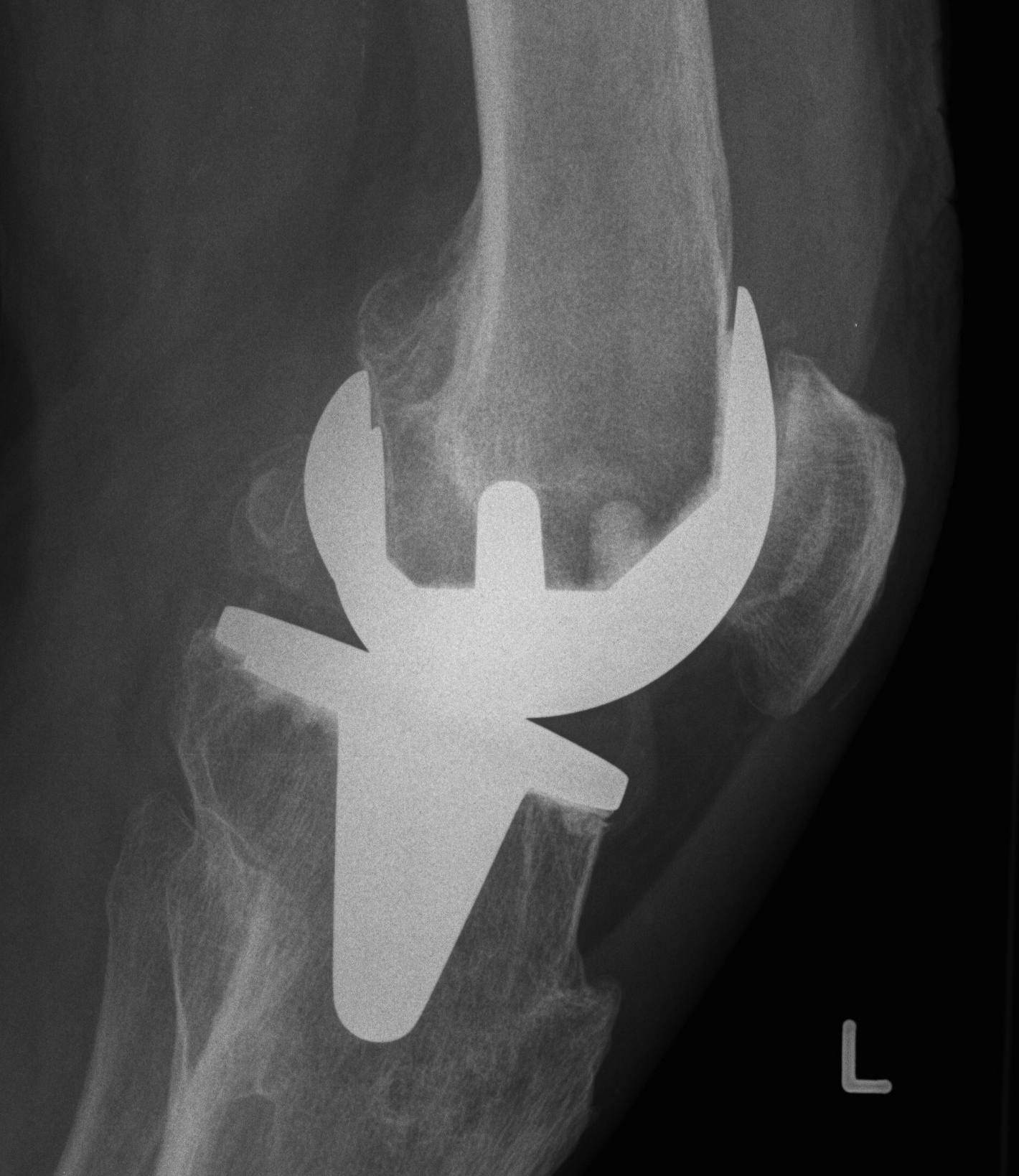 Instability | The Bone School