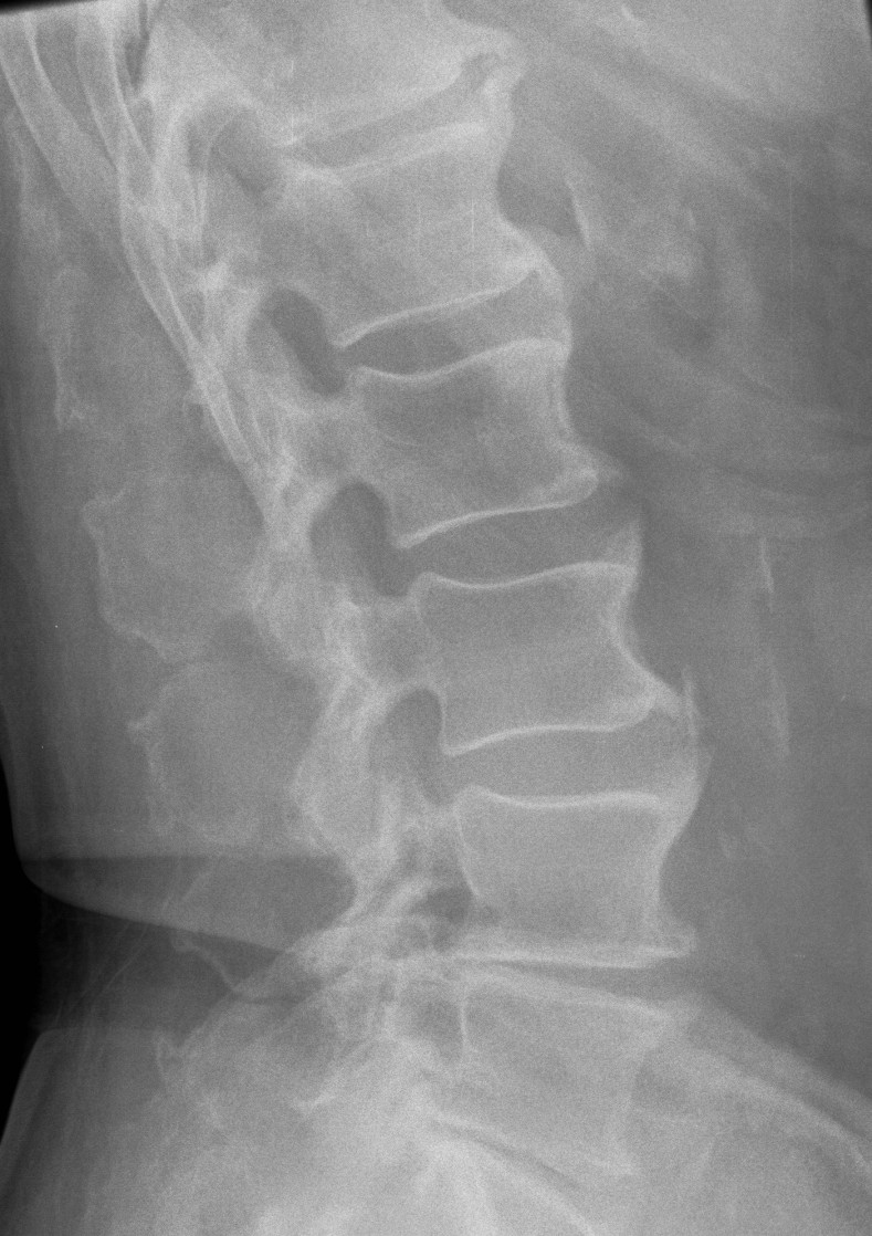 DISH | The Bone School