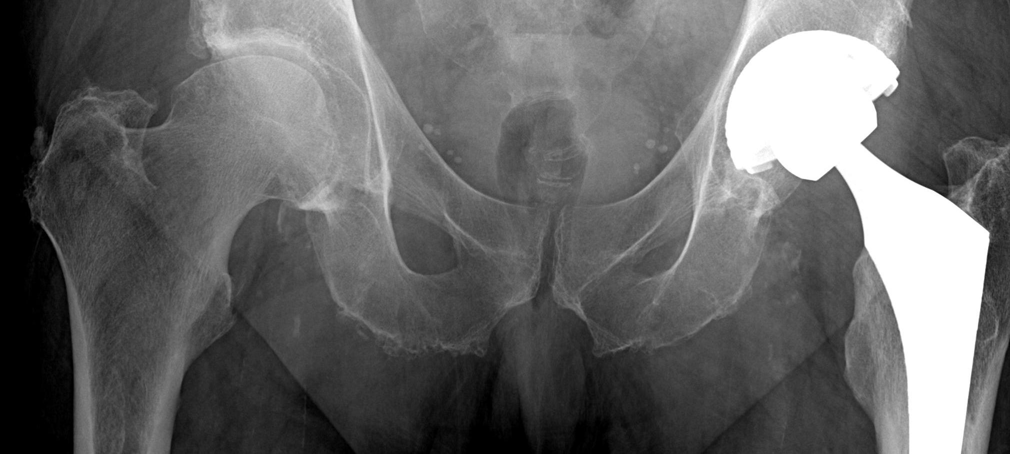 DISH | The Bone School