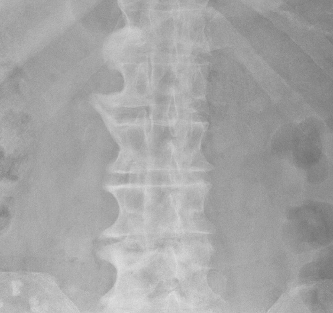 DISH | The Bone School