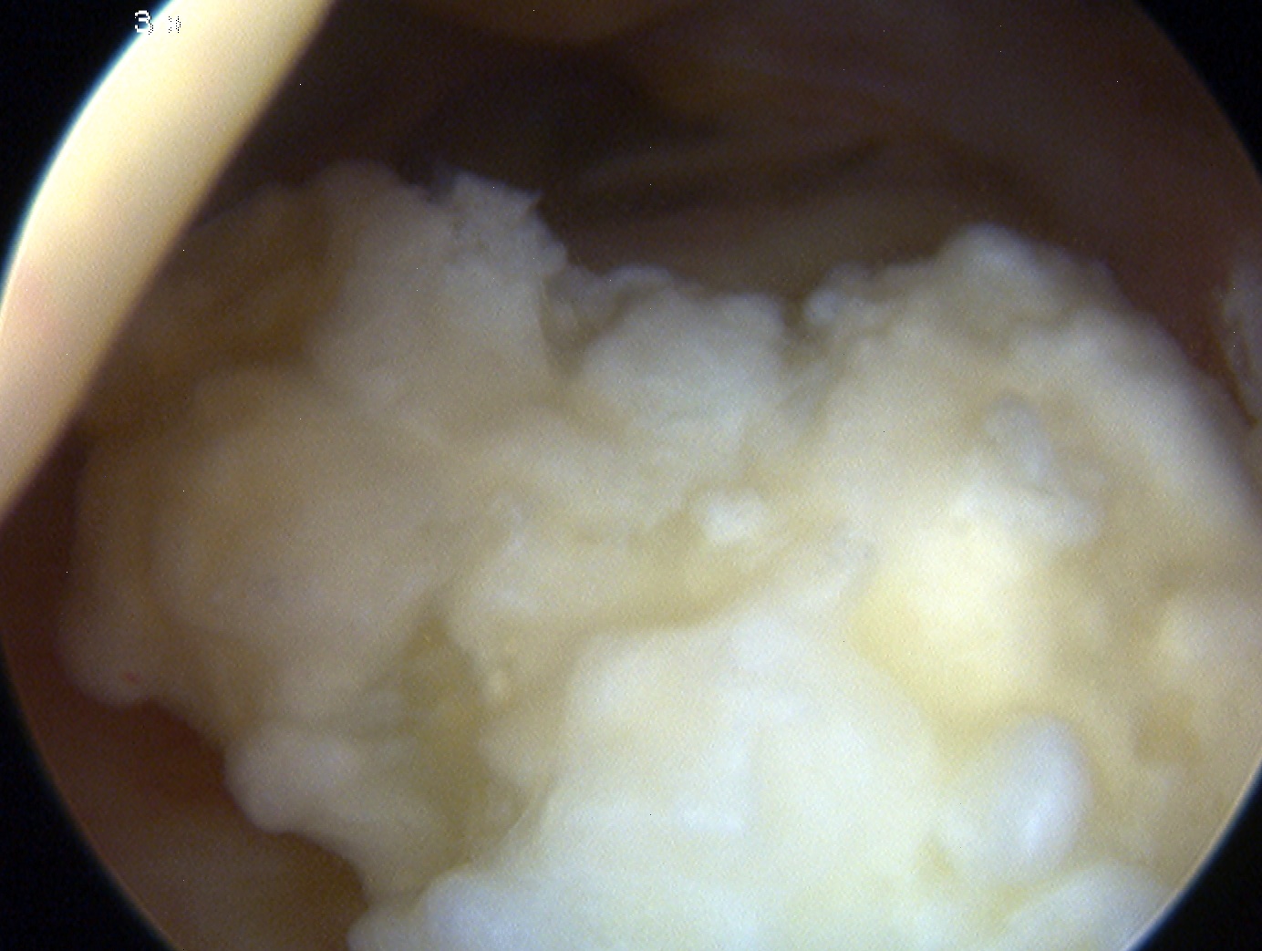 Arthroscopy | The Bone School