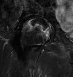 Background | The Bone School