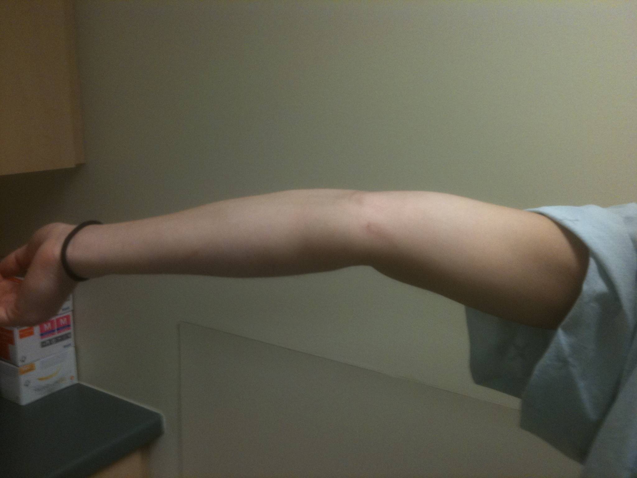 Shoulder | The Bone School