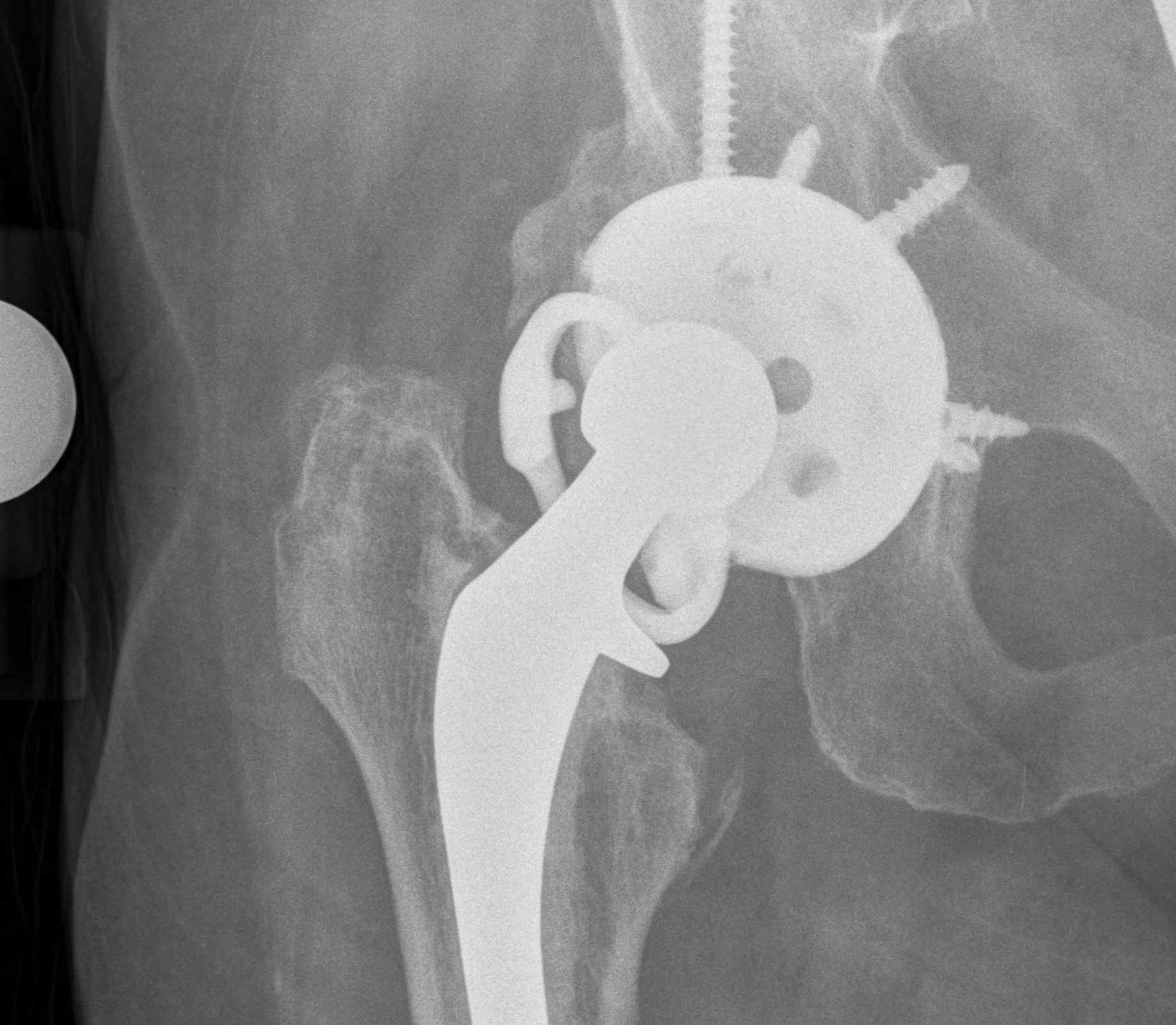 Dislocation | The Bone School