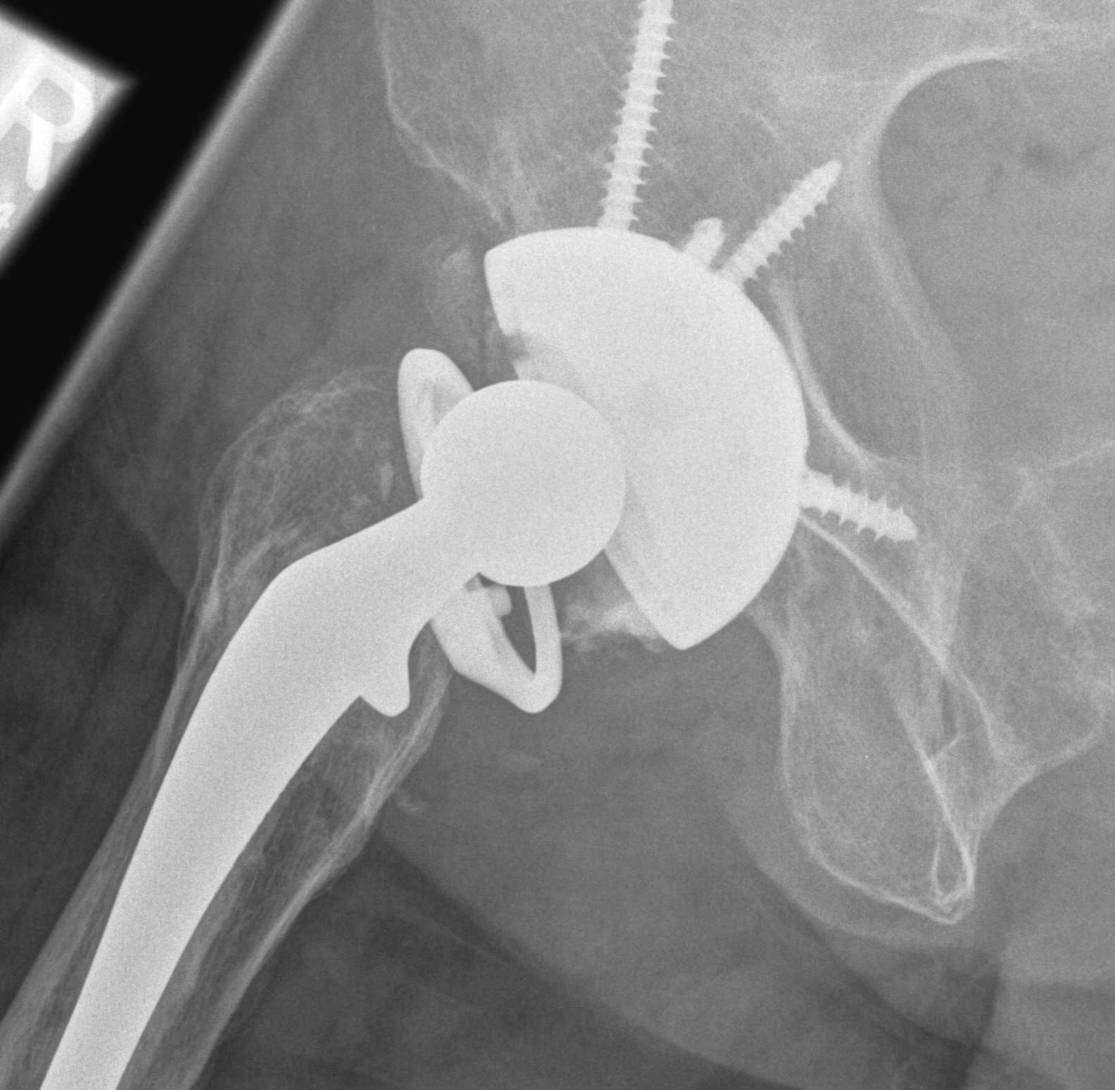 Dislocation | The Bone School