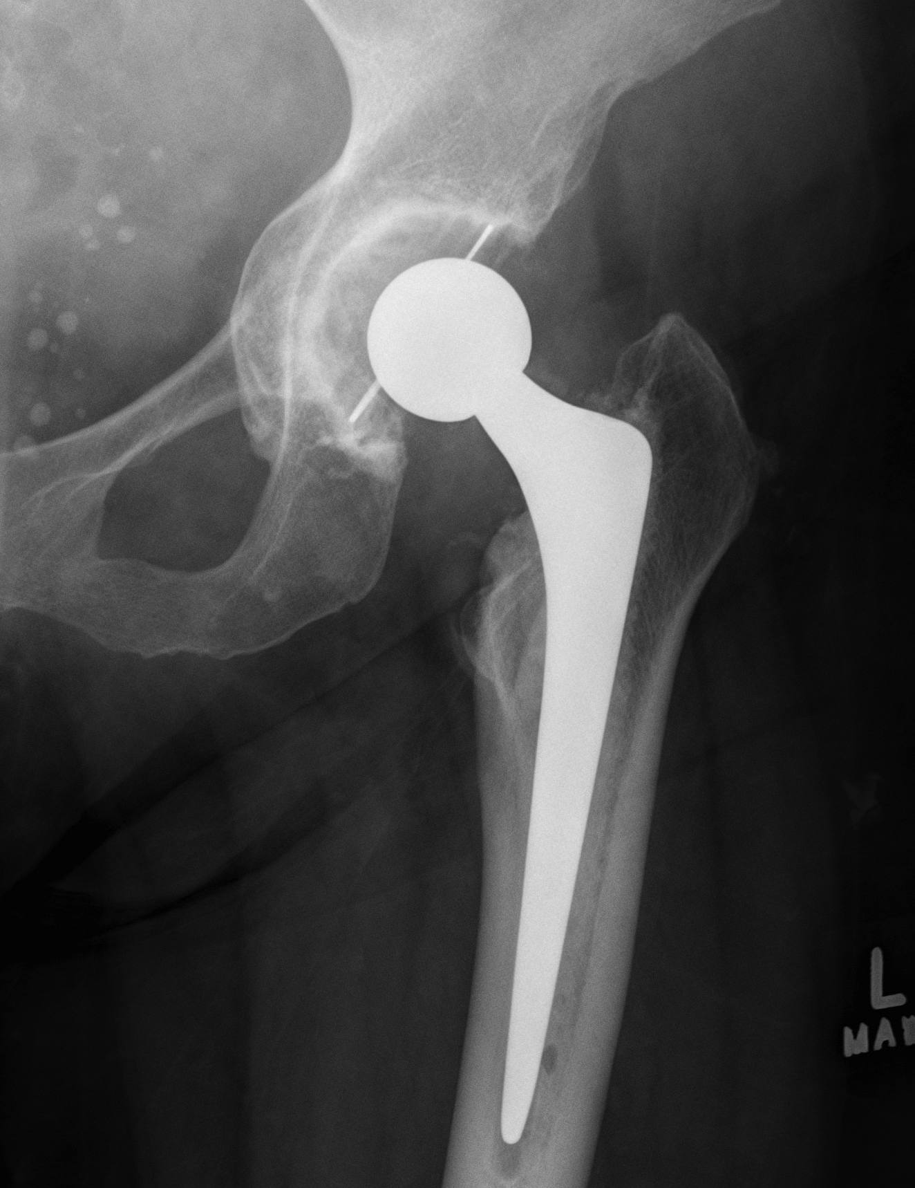 Protrusio | The Bone School