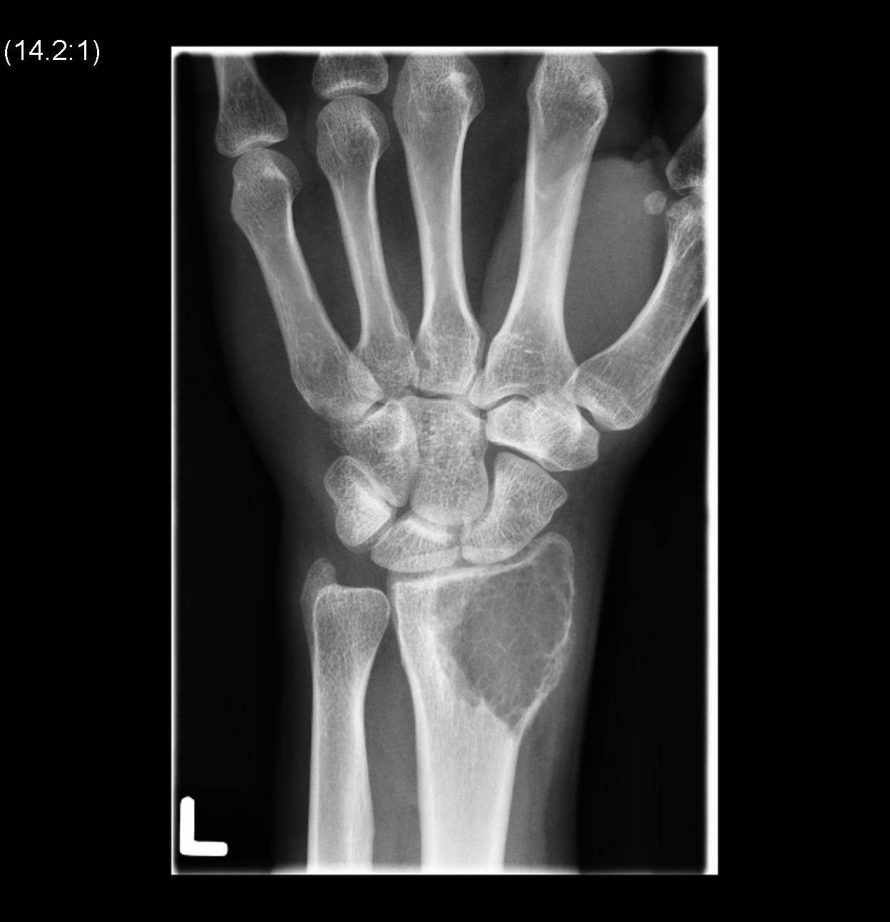 Biopsy Anatomical Approach | The Bone School