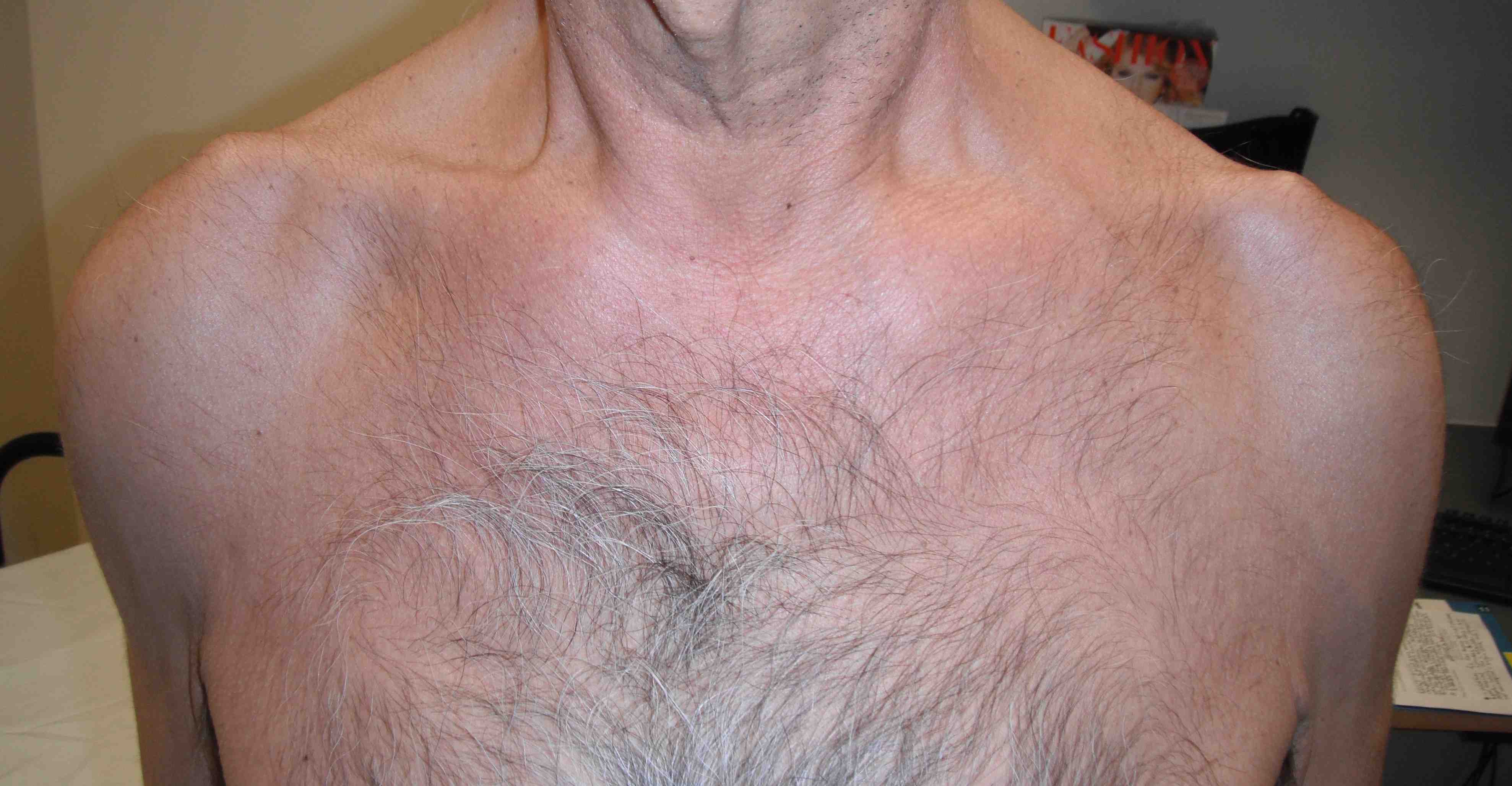 Shoulder | The Bone School