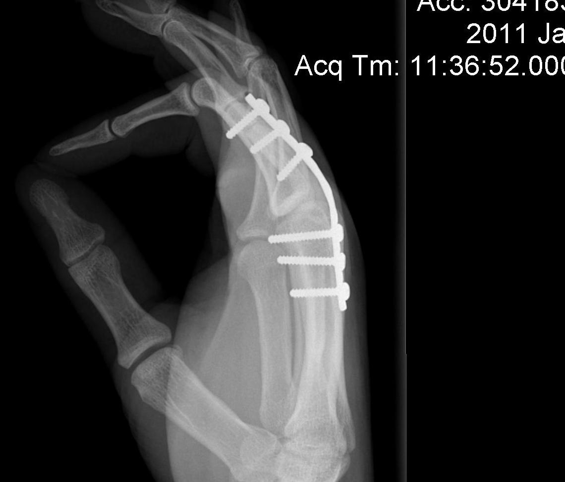 Finger | The Bone School