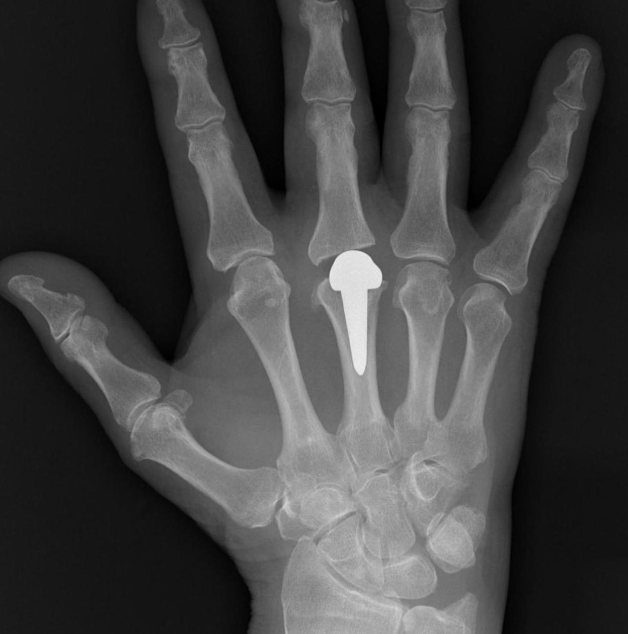 Finger | The Bone School