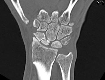 wrist | The Bone School
