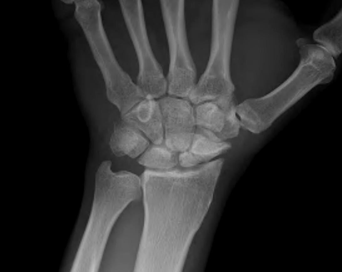 wrist | The Bone School