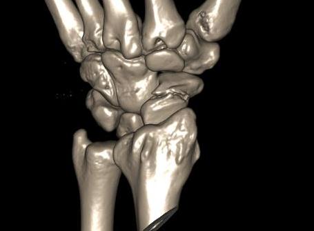 CT Scan | The Bone School