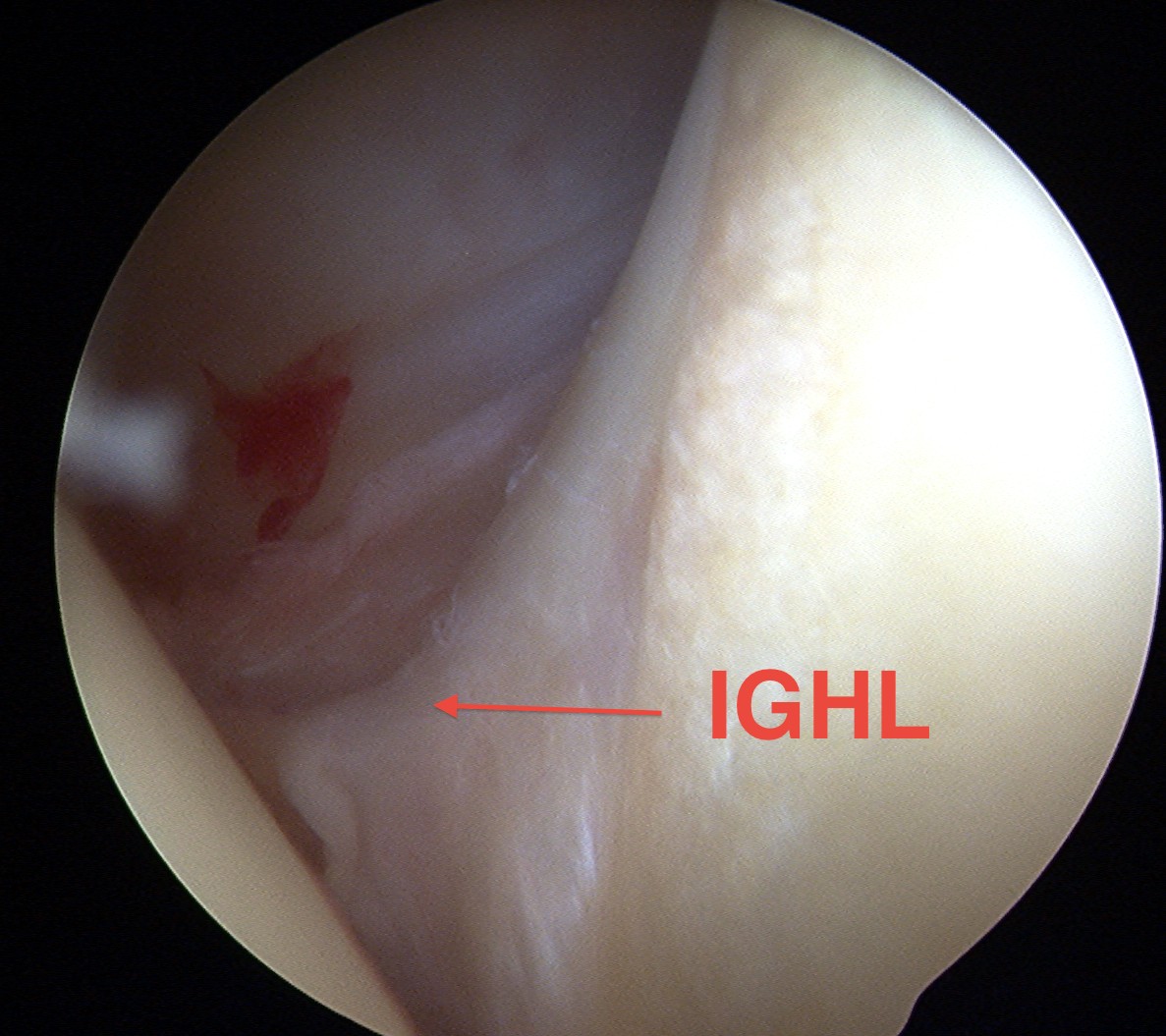 Arthroscopy | The Bone School