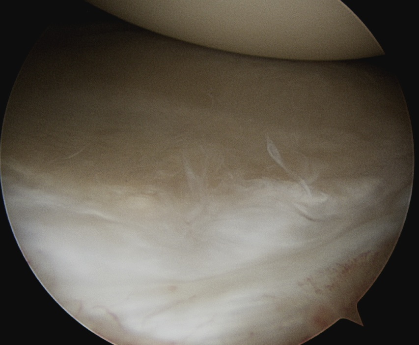 Arthroscopy | The Bone School