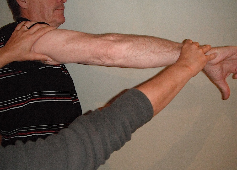 Rotator cuff tendinopathy | The Bone School