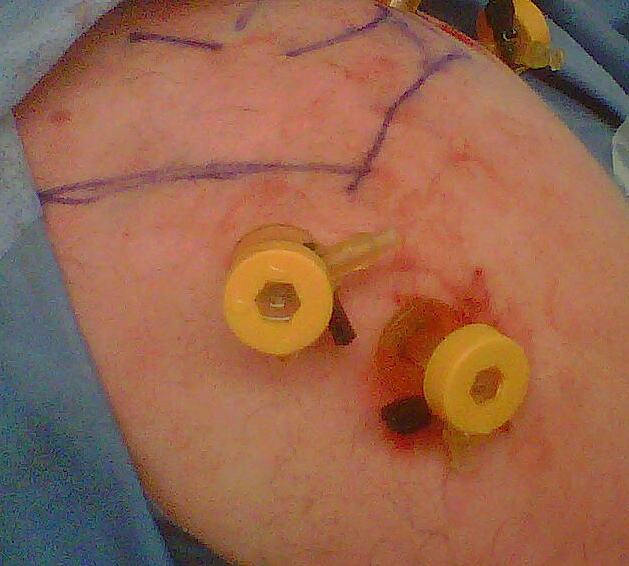 Arthroscopy | The Bone School