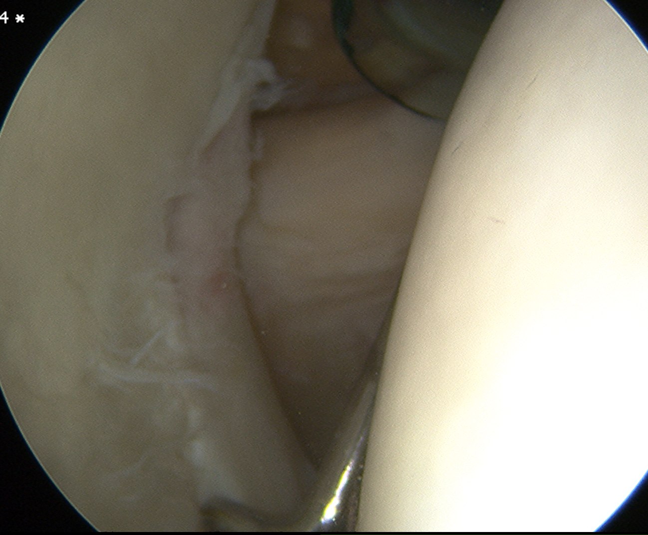 Arthroscopy | The Bone School