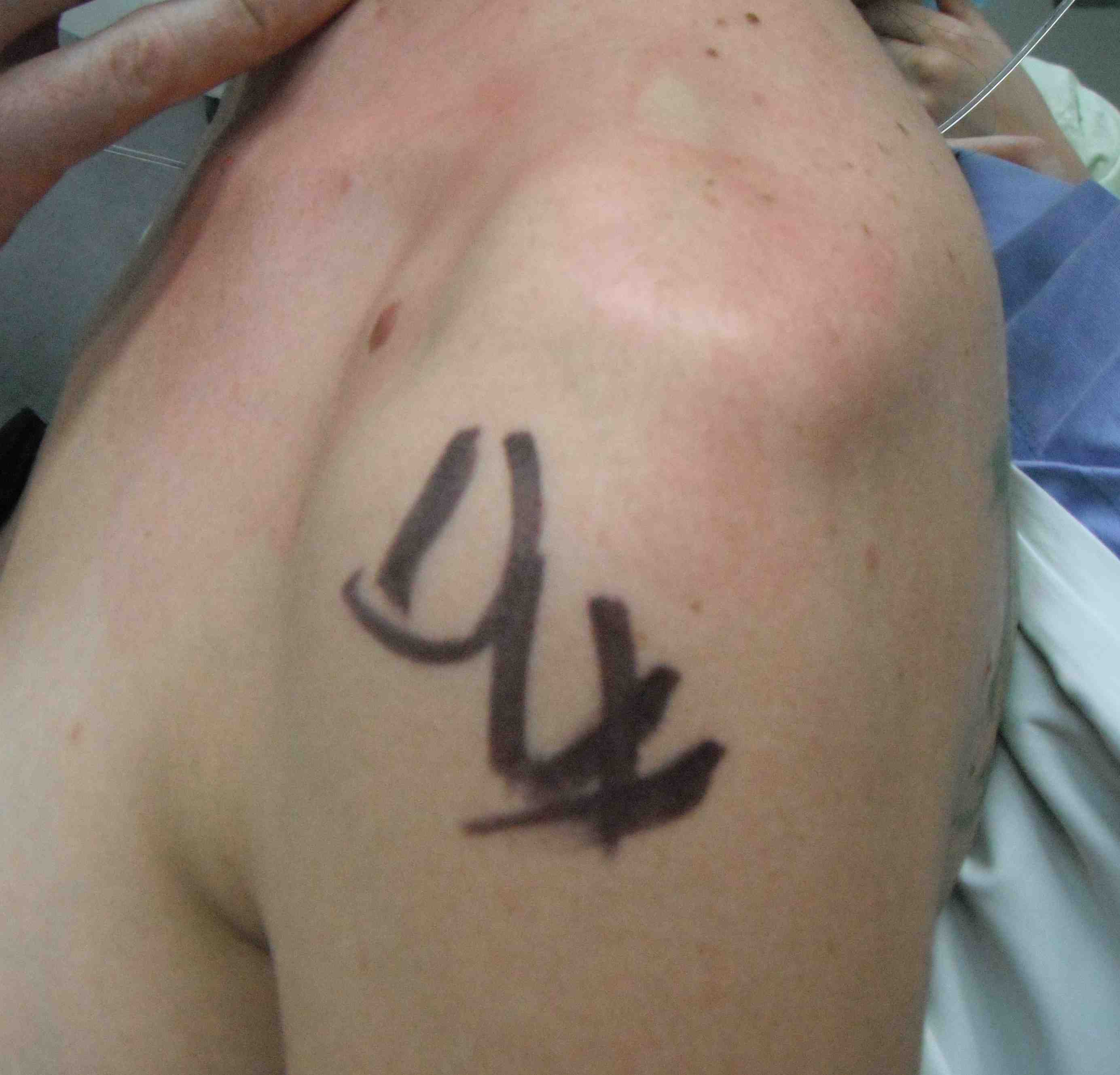 Shoulder | The Bone School