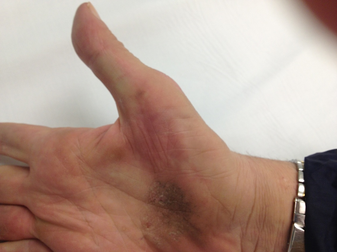 wrist examination | The Bone School