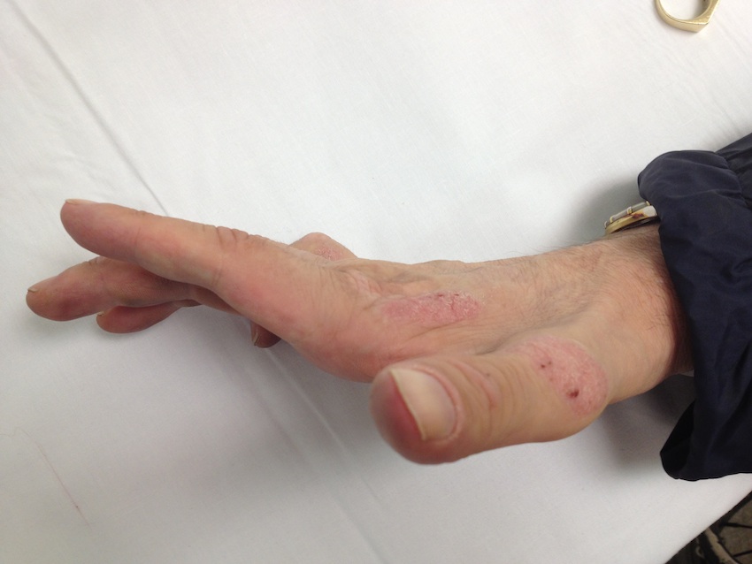 Ulnar Nerve Exam | The Bone School