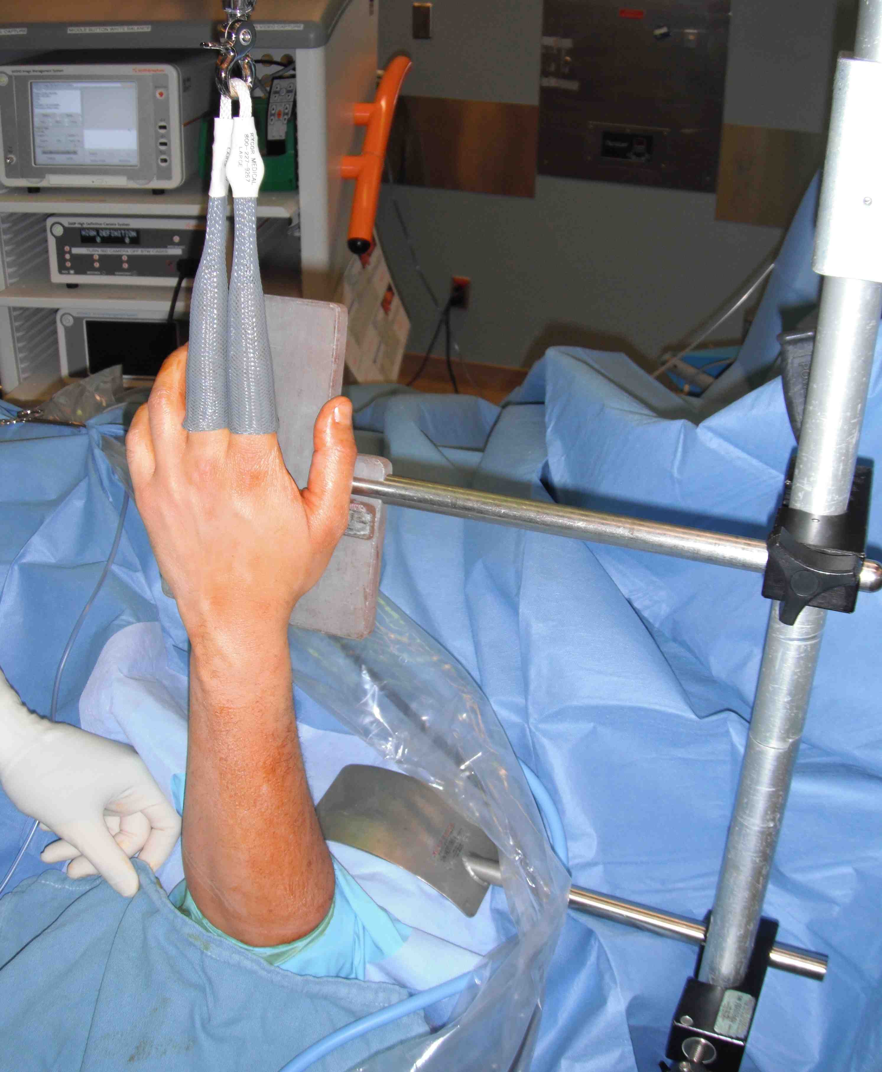 Arthroscopy | The Bone School