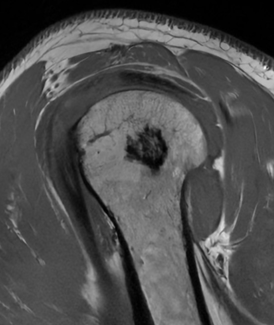 Bone island | The Bone School