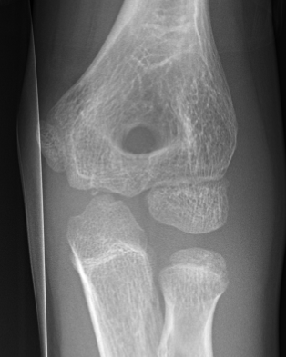 Centers of Ossification | The Bone School